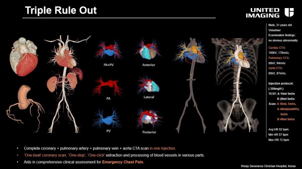 원주세브란스기독병원이 UIH사 CT를 선택한 이유는?