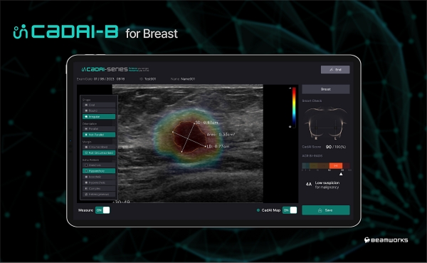 [HIMSS24 APAC] 빔웍스, 유방암 초음파 실시간 AI 진단 ‘CadAI-B’ 출품