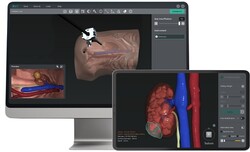 휴톰, CMEF서 AI 수술 내비게이션 ‘러스’ 전시·시연