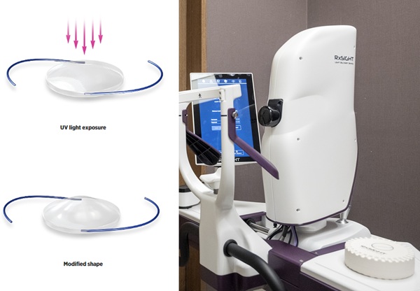 센트럴서울안과, 국내 최초 Light Adjustable Lens™(LAL) 및 LDD 장비 도입